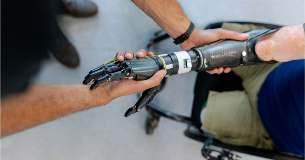 The Saving Lives project launched the prosthetics program – War in ...